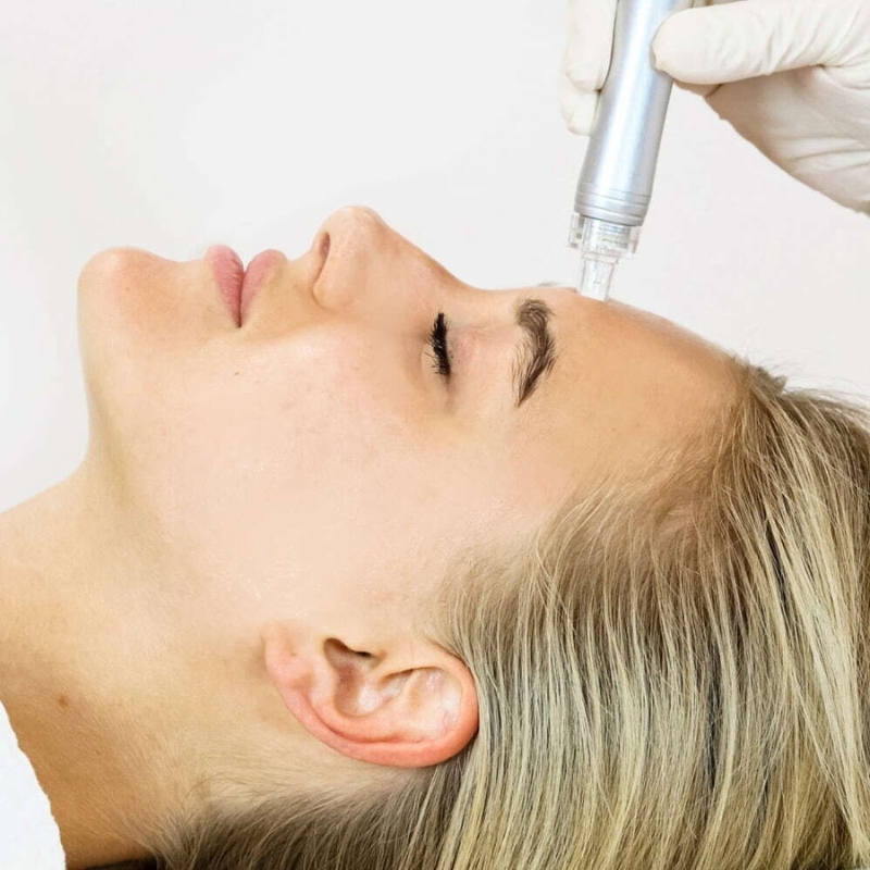 Zemits Verstand HD Full-Feature Facial System FOR SALE